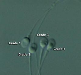 IMSI Technique and IVF | Dogus IVF Fertility Center